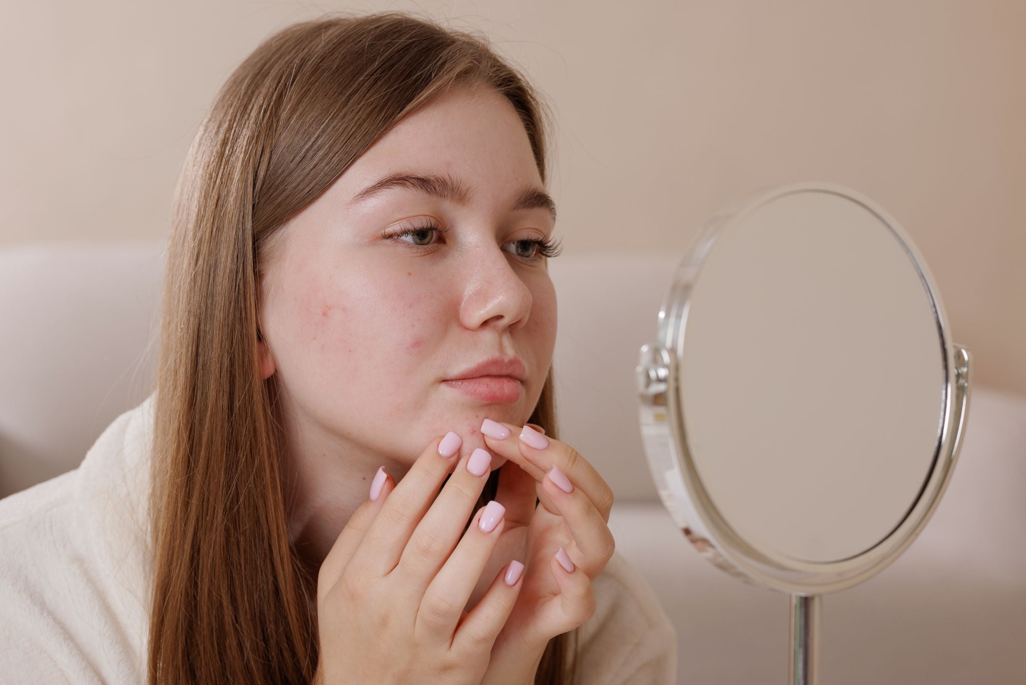 Acné juvénile : soigner naturellement la peau d’un ado